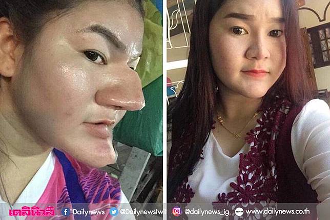 เปิดใจ!สาวคลิปจมูกแม่มด วอนชาวเน็ตตั้งสติอย่าดราม่า