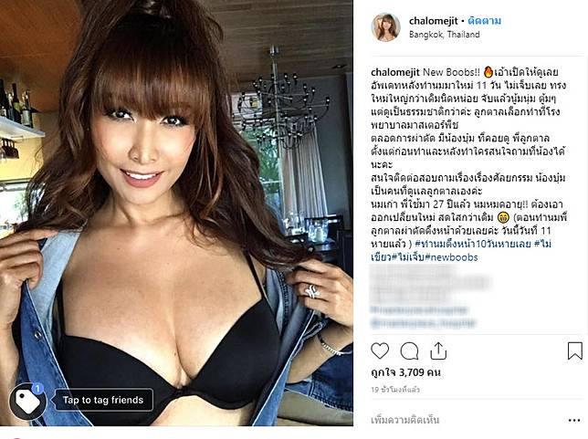 SpringNews | " ลูกตาล ชโลมจิต" นม 27 ปีพัง ผ่าตัดอัพใหม่-ดึงหน้า แซ่บกว่าเดิม