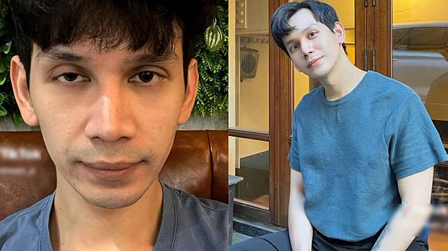 หนุ่มฝังใจโดนเพื่อนล้อวัยเด็ก ควัก 36ล้านวอน โมหน้าใหม่หล่อปิ๊ง | Khaosod | LINE TODAY