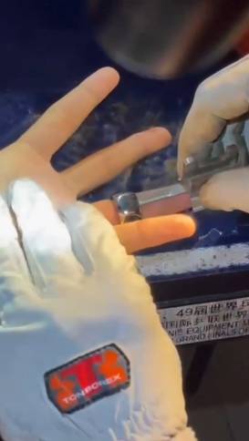 Firefighters remove steel nut stuck on student's finger | XINHUA | LINE ...