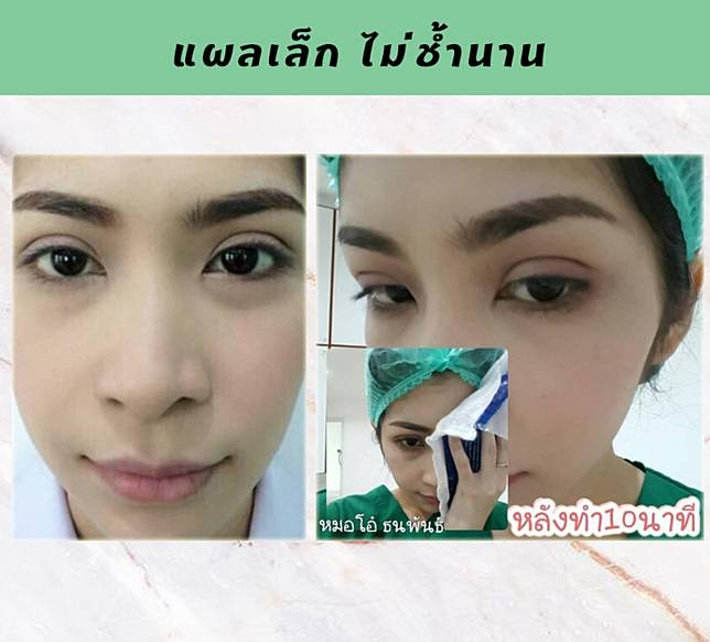 Akeru Feed | จัดอันดับ 5 คลินิกทำตาสองชั้นคุณภาพ ไม่ต้องไปไกลถึงเกาหลี