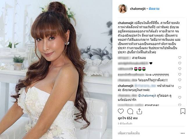 SpringNews | " ลูกตาล ชโลมจิต" นม 27 ปีพัง ผ่าตัดอัพใหม่-ดึงหน้า แซ่บกว่าเดิม