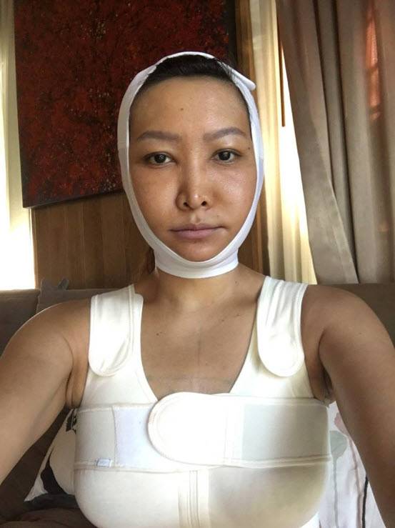 SpringNews | " ลูกตาล ชโลมจิต" นม 27 ปีพัง ผ่าตัดอัพใหม่-ดึงหน้า แซ่บกว่าเดิม