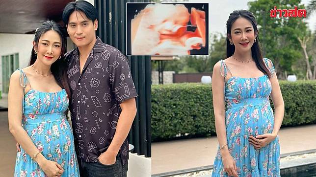 ยุ้ย จีรนันท์ อวดคลิปอัลตร้าซาวด์ลูกยิ้มให้ นับถอยหลังใกล้คลอด! | Khaosod | LINE TODAY