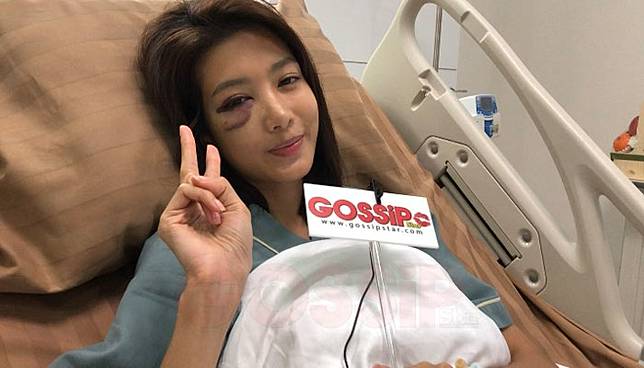 Gossipstar.com | ยิ้มสู้! ไอซ์ เส้นเลือดฝอยในตาแตก! ไฮโซนิน ห่วงหนักมาก