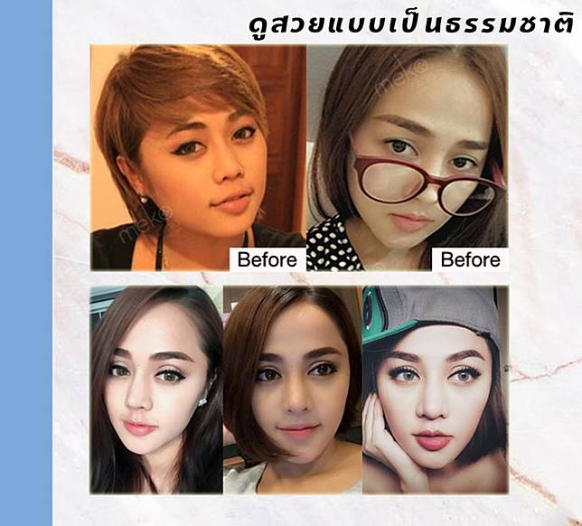 Akeru Feed | จัดอันดับ 5 คลินิกทำตาสองชั้นคุณภาพ ไม่ต้องไปไกลถึงเกาหลี