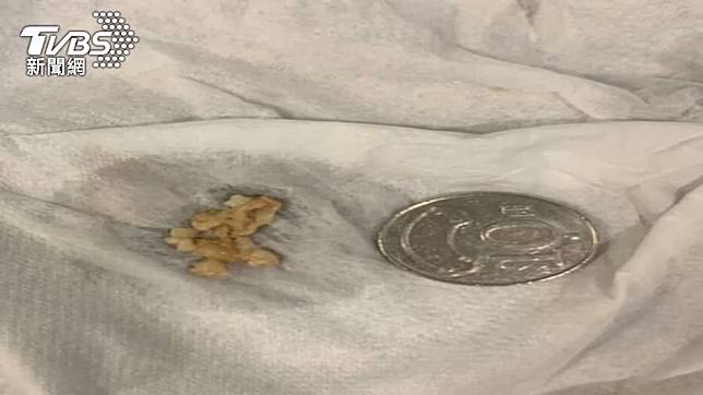 這不是特調！手搖竟吸到「肥肉」 女崩潰：噁心 | TVBS | LINE TODAY