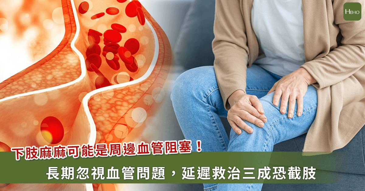 下肢麻、痛、傷口不癒是周邊血管阻塞釀禍！延遲診斷 3 成難逃截肢 | Heho健康 | LINE TODAY