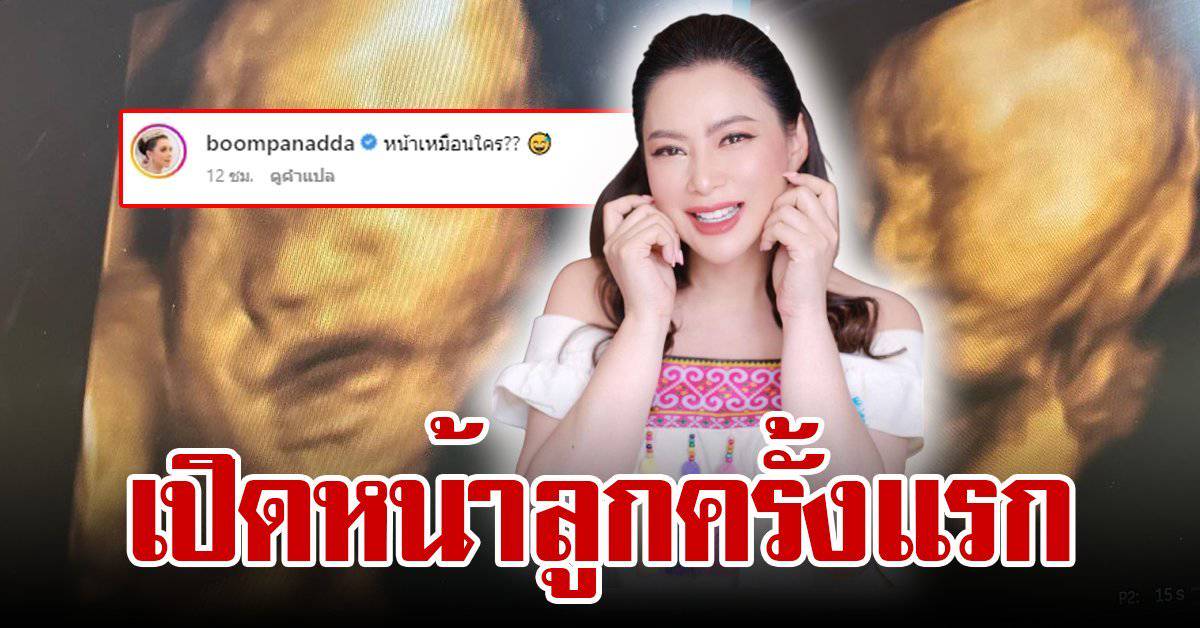 หน้าเหมือนใคร? บุ๋ม ปนัดดา เผยภาพลูกชายครั้งแรกชัดๆ | Jarm.com | LINE TODAY