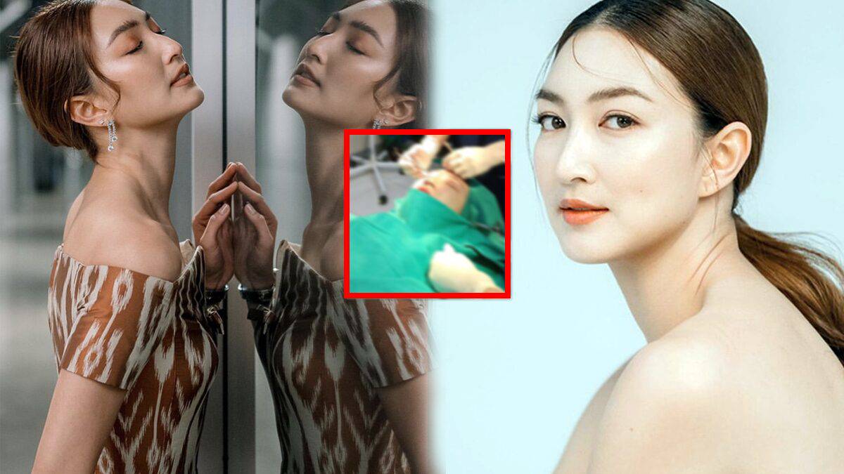 สวยจึ้ง เปิดโฉมใหม่ “แพนเค้ก เขมนิจ” ศัลยกรรมครั้งแรกในชีวิต | Khaosod | LINE TODAY