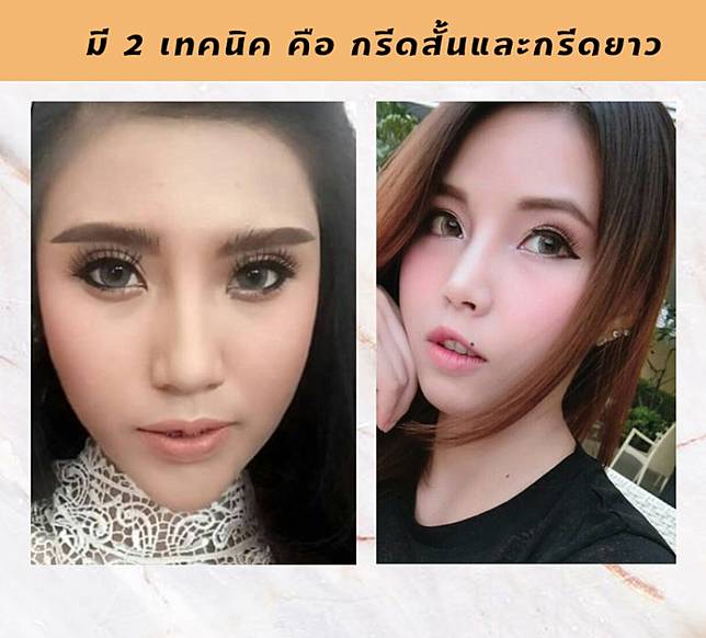 Akeru Feed | จัดอันดับ 5 คลินิกทำตาสองชั้นคุณภาพ ไม่ต้องไปไกลถึงเกาหลี