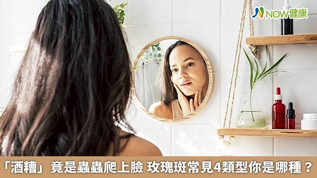 「酒糟」竟是蟲蟲爬上臉 玫瑰斑常見4類型你是哪種？ Now健康 Line Today