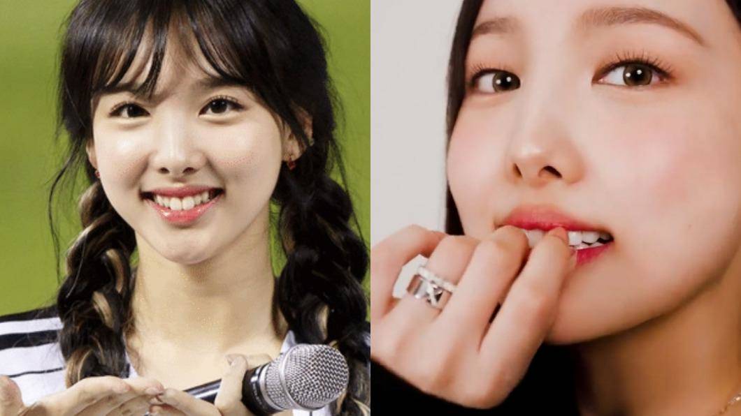 TWICE娜璉超萌兔牙真的沒了！ 「術後最新長相」曝光 | TVBS | LINE TODAY