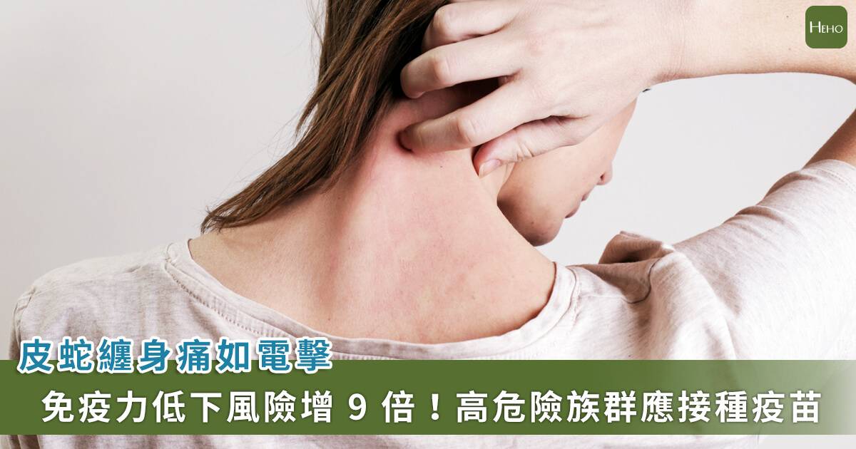 26 歲皮蛇纏身、5 年復發 4 次！世界免疫週醫呼籲：12類高危族群及早施打疫苗 Heho 健康（台灣） Line Today