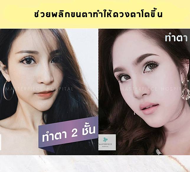 Akeru Feed | จัดอันดับ 5 คลินิกทำตาสองชั้นคุณภาพ ไม่ต้องไปไกลถึงเกาหลี