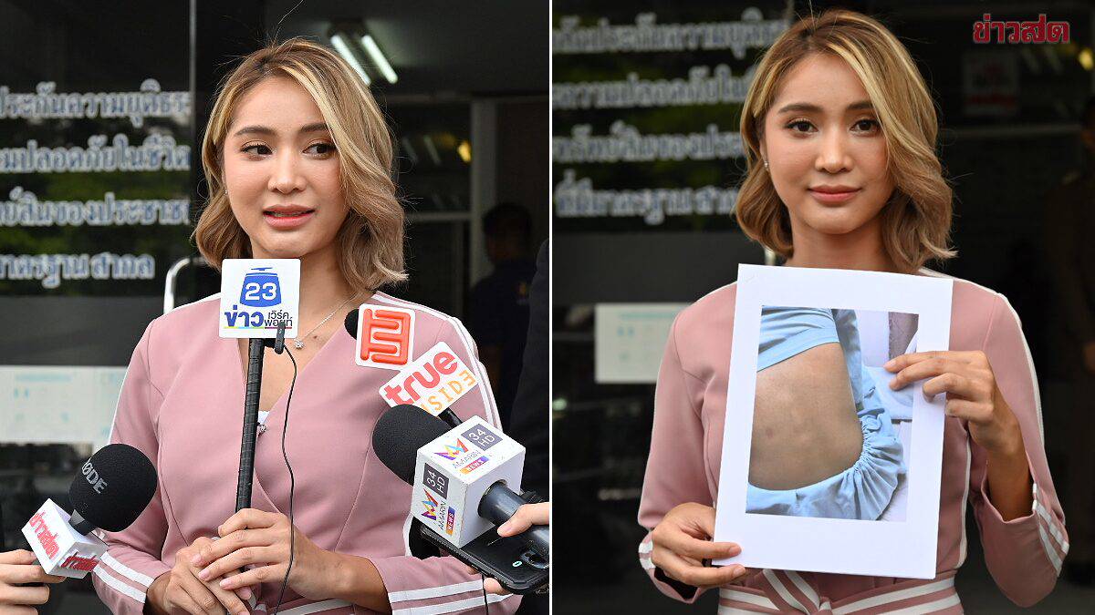 มินดา แจ้งความแล้ว! แฉพฤติกรรม พระเอก ฟ. ข่วนเนื้อหลุด-ทำร้ายตัวเอง | Khaosod | LINE TODAY