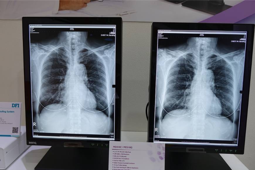 《12月營收》佳世達轉型/12年同期高；GIS同期高 | MoneyDJ理財網 | LINE TODAY