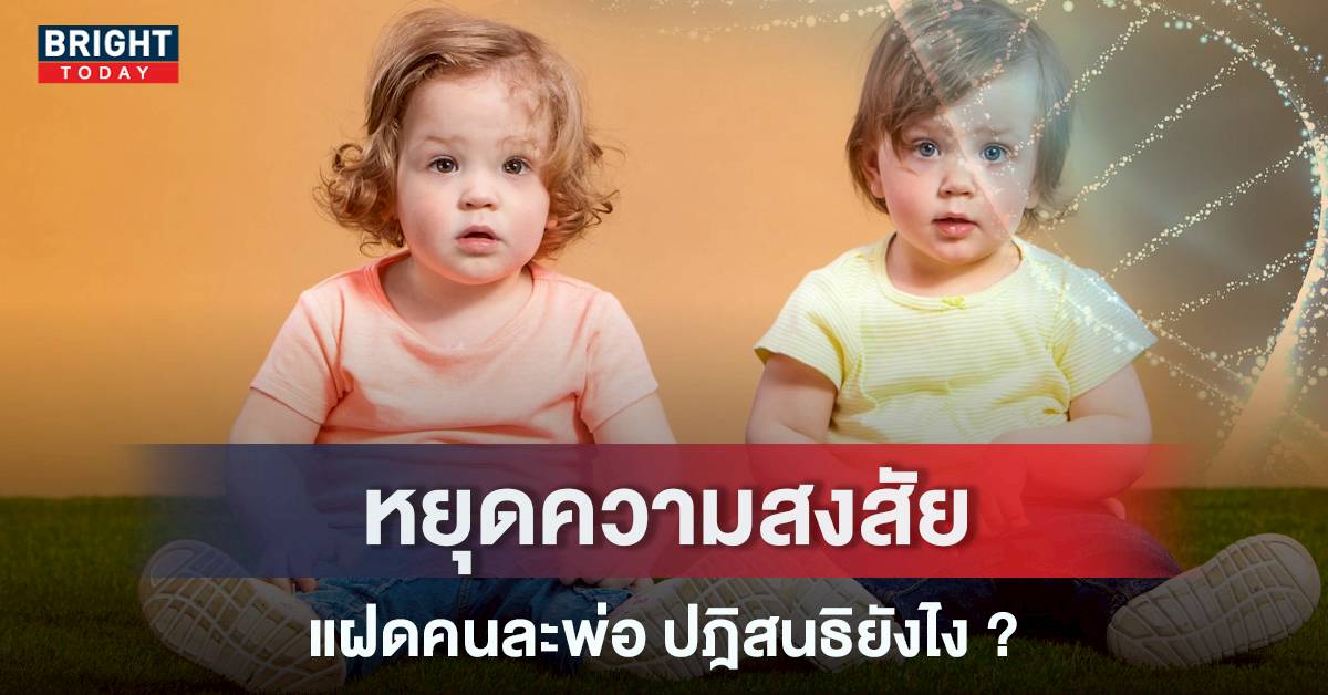 ไขข้อสงสัย Heteropaternal superfecundation คืออะไร แฝดคนละพ่อ เกิดขึ้น ...
