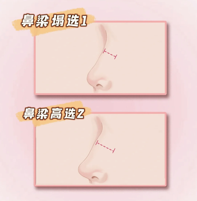 四步驟測出你是甜甜校花or高冷感美女！「甜鹽苦辣長相測驗」測出適合的髮型、妝容，讓顏值翻倍跳！ Line購物