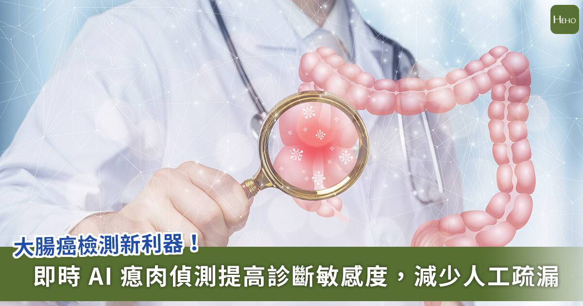 大腸癌預防添利器！ AI 偵測揪出隱藏瘜肉準確度達96％ | Heho健康 | LINE TODAY
