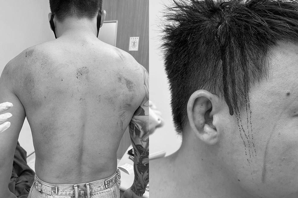 Toyz遭超哥爆揍後首發聲 貼2千字文反嗆：你的醋飯夠難吃 | 上報 | LINE TODAY