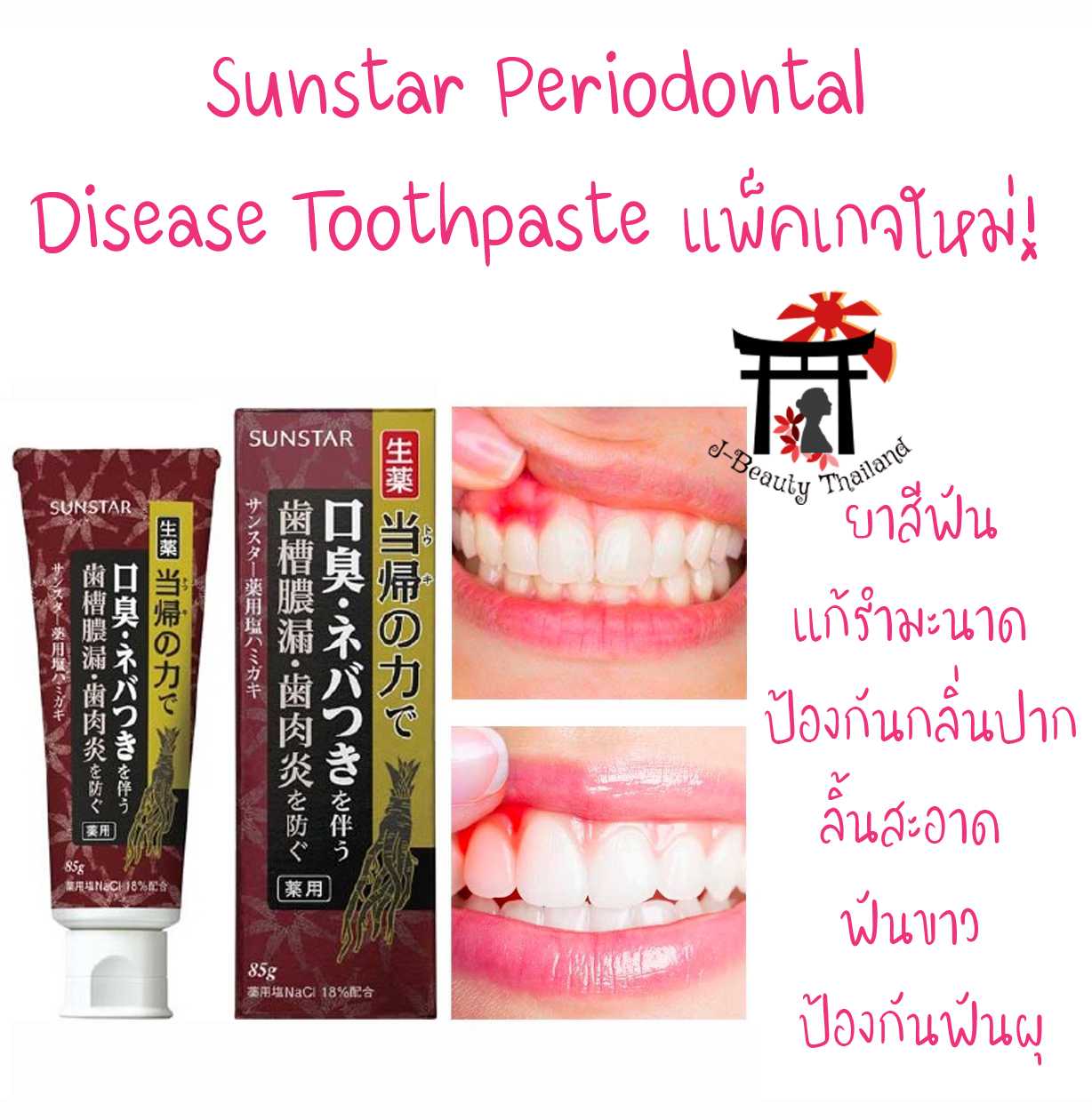 Sunstar Periodontal Disease Toothpaste ยาสีฟันลดรำมะนาด ป้องกันกลิ่นปาก ...