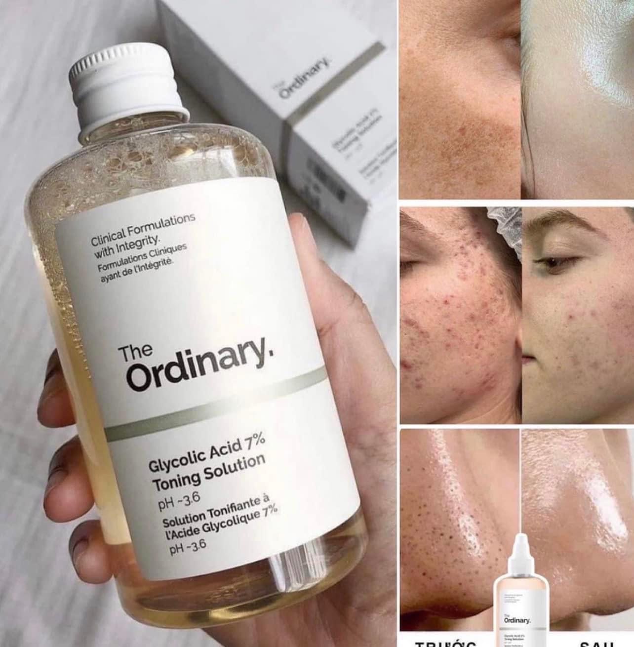 โทนเนอร์ The Ordinary Glycolic Acid 7% Toning Solution | LINE SHOPPING