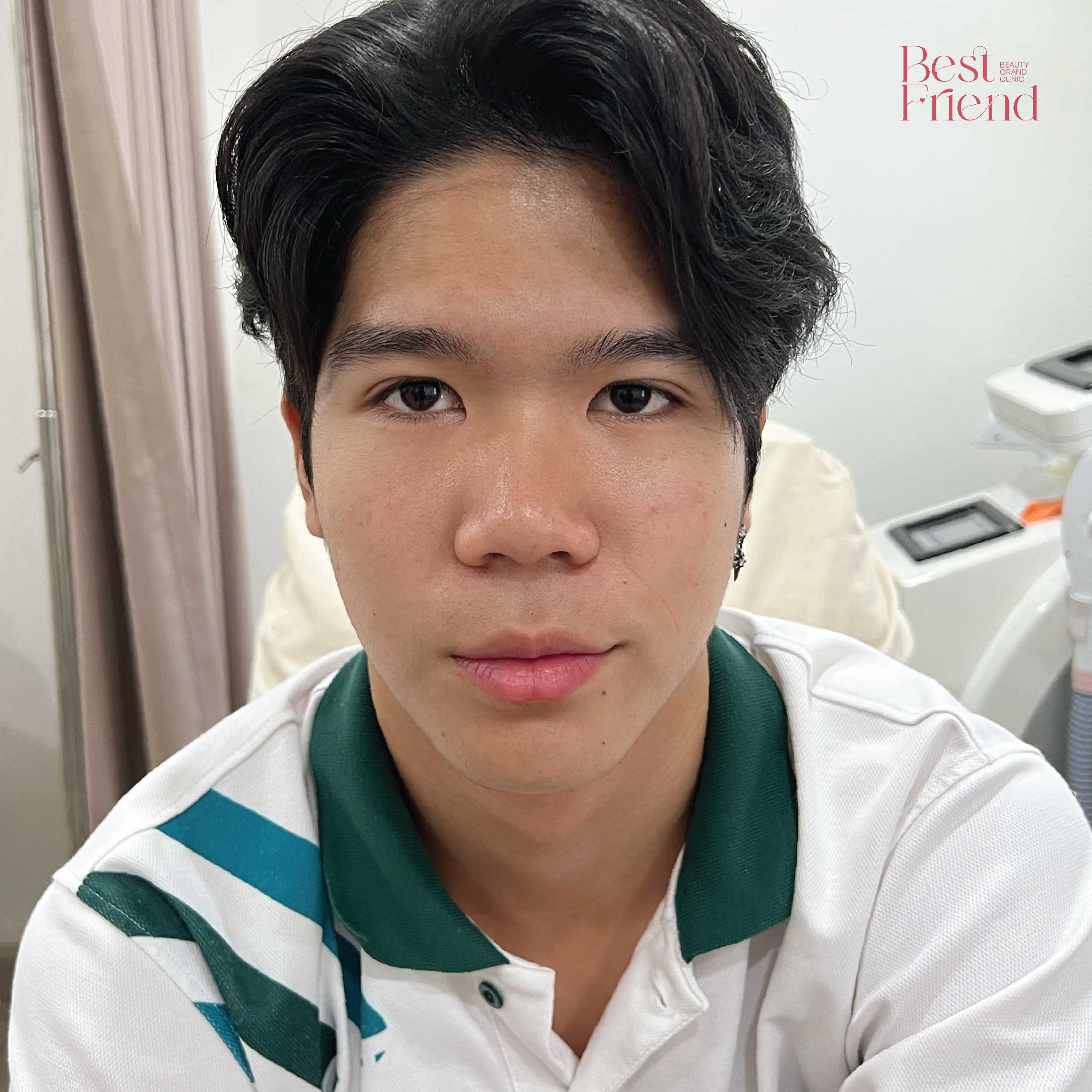 BOOSTER GANG รวมตัวช่วยบูสต์ผิวสวยด้วยโปรแกรม 𝐆𝐥𝐚𝐬𝐬 𝐒𝐤𝐢𝐧 👸🏻 | LINE SHOPPING