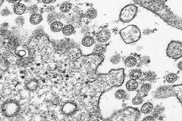 撮影中止で拡散防止に成功…AV業界で「男優4人」がコロナ感染（SmartFLASH）